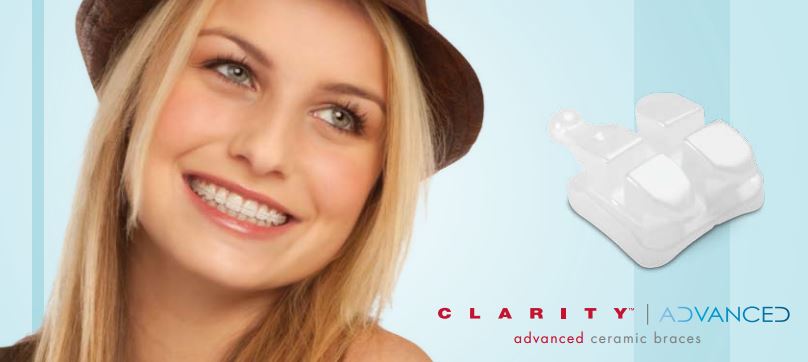Clarity™ ADVANCED - Juan Carlos Estrada Ortodoncista